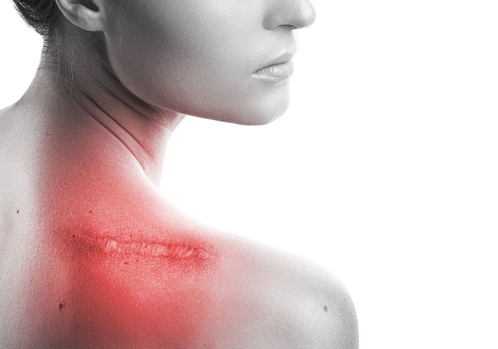 Conoscere le cicatrici